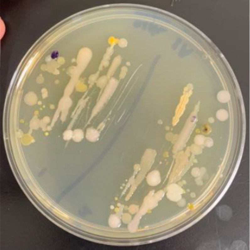 How Curiosity Led to the Discovery of a New Species of Bacteria in ...