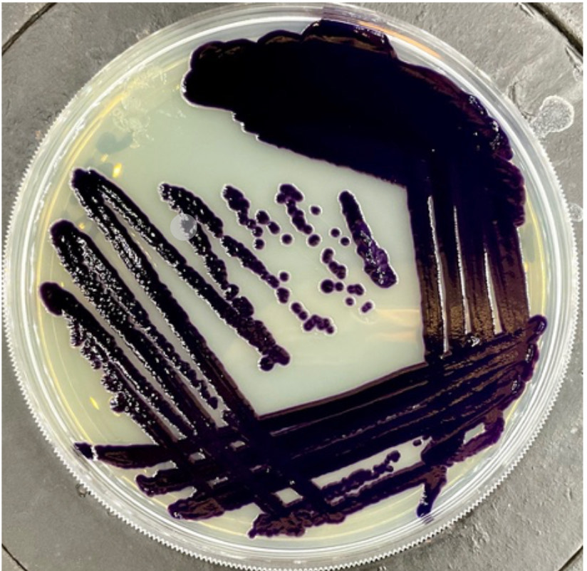 How Curiosity Led to the Discovery of a New Species of Bacteria in ...